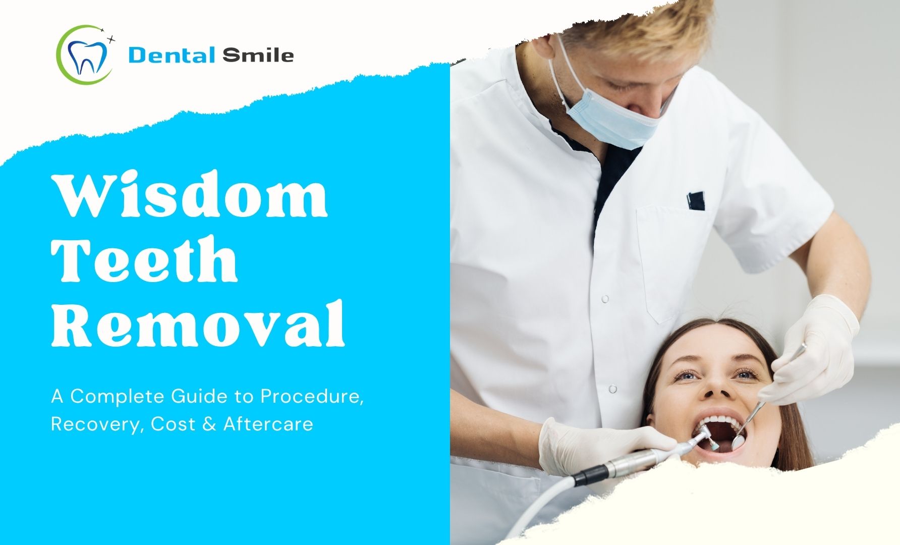 Wisdom Teeth Removal A Complete Guide